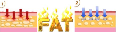 invisa-RED Laser Columbia City IN | Whitley Chiropractic