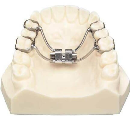 How to Activate Your Fixed Expander Plate/RME | Wavescape Orthodontics