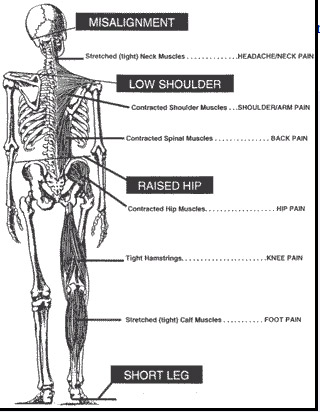 Chesapeake Nucca Chiropractor, Chesapeake Upper Cervical | Precision ...